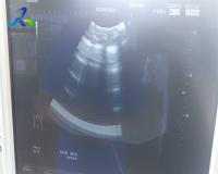 China Hitachi Aloka Ascendus Image Shadow Ultrasound Machine Repair Replace TRX Board for sale