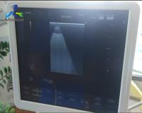 China Hitachi Aloka Ascendus Image Shadow Ultrasound Machine Repair Replace TRX Board for sale