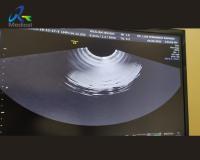 China GE Voluson S6 BF128 5728959 Ultrasound Repair Service 60 Days Warranty for sale