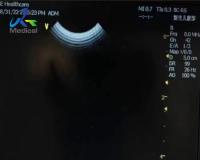 China GE 8C-RS Micro Convex Ultrasound Transducer Probe Cable And Crystal Array Replacement for sale
