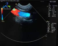 China GE 8C-RS Micro Convex Ultrasound Transducer Probe Cable And Crystal Array Replacement for sale