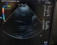 China GE 8C-RS Micro Convex Ultrasound Transducer Probe Cable And Crystal Array Replacement for sale
