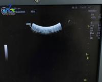 China GE 4C-RS Convex Probe Ultrasound Transducer Lens Replacement for sale