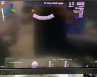 China GE Voluson E10 Ultrasound Machine Repair All Probes Without Echo Repair RFM423 for sale