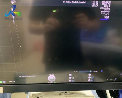 China GE Voluson E10 Ultrasound Machine Repair All Probes Without Echo Repair RFM423 for sale