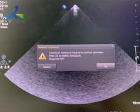 China EPIQ 5 Ultrasound Machine Repair Startup Report Error 511 Replace ACQ for sale