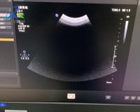 China EPIQ 5 Ultrasound Machine Repair Startup Report Error 511 Replace ACQ for sale