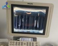 China HD11 Image Blurred Image Anomaly Ultrasound Machine Repair Monitor for sale
