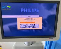 China IU22 Ultrasound Machine Repair Report Error 511 At Startup for sale