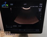 China Hitachi ARIETTA 60 Can Not Start Up Ultrasound Machine Repair Replace BE Board for sale