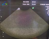 China GE RIC5-9-D Ultrasound Probe Repair Crystal Array 4D Dome Cable Replacement for sale