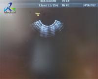 China GE RIC5-9-D Ultrasound Probe Repair 4D Replace Dome And Crystal Array for sale