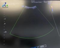 China Ultrasound Probe Transducer Replce Strain Relief Cable And Lense Samsung CA1-7A for sale