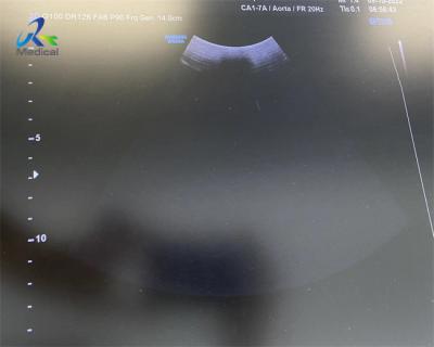 China Ultrasound Probe Transducer Replce Strain Relief Cable And Lense Samsung CA1-7A for sale