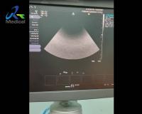 China Siemens S1000 Ultrasound Machine Repair Service No Image And Waveform In Mode And Can'T Switch To 14L5 Probe for sale