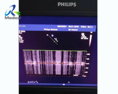 China IE ELITE Ultrasound Machine Repair Clutter Interference Cw Function for sale