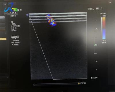 China L12-3 Linear Array Ultrasound Transducer Probe Replace Strain Relief Crystal And Cable for sale