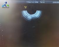 China GE RIC5-9-D Ultrasound Probe Repair 4D Replace Dome for sale