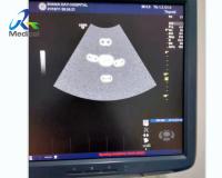 China GE Logiq E9 Ultrasound Machine Repair Displays Virtual Image Replace Power Supply for sale