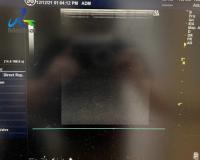 China GE Logiq S6 Ultrasound Machine Repair Displays Virtual Plot And No Echo Zone for sale