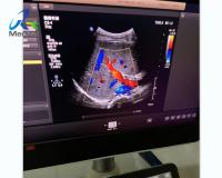 China EPIQ 7 Report Error 227 Ultrasound Machine Repair Replace ACB Board for sale