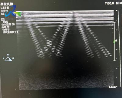 China EPIQ 5 Ultrasound Machine Repair All Probe Images Are Abnormal Replace ACQ for sale