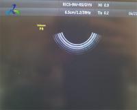 China GE RIC5-9W-RS Ultrasound Probe Repair 4D Replace Dome And Oil Filling for sale