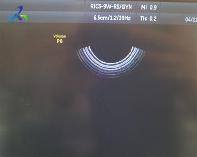 China GE RIC5-9W-RS Ultrasound Probe Repair 4D Replace Dome And Oil Filling for sale
