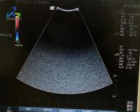China GE 8C-RS Ultrasound Probe Repair Service Acoustic Lens Replacement for sale