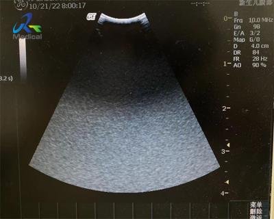 China GE 8C-RS Ultrasound Probe Repair Service Acoustic Lens Replacement for sale