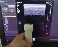 China EPIQ Ultrsaound Machine Repair Version A ACQ Ultrasound Board for sale