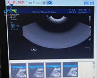 China HD15 Ultrasound Machine Repair Blood Flow Interference Replace ACB Board for sale
