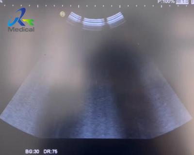 China Hitachi Noblus Image Missing Ultrasound Machine Repair EUB-5500 MAP-A WU8012-2 for sale