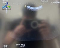 China Hitachi Noblus Image Missing Ultrasound Machine Repair EUB-5500 MAP-A WU8012-2 for sale