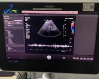 China EPIQ 5 Ultrasound Machine Repair Report Error When Switch Probe Replace ACQ 453561184013 for sale