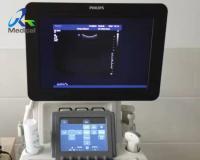 China IU ELITE Ultrasound Machine Repair Report Error 005 Replace SPD Board for sale