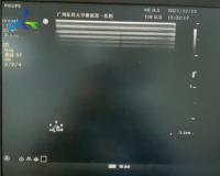 China Sparq Ultrasound Machine Repair Abnormal Image Replace Channel Board 453561184013 for sale