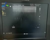 China Sparq Ultrasound Machine Repair Abnormal Image Replace Channel Board 453561184013 for sale