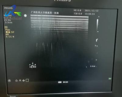 China Sparq Ultrasound Machine Repair Abnormal Image Replace Channel Board 453561184013 for sale