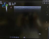 China Biosound Biosound SL1543 Linear Array Ultrasound Probe Repair Replace Lens And Crystal for sale
