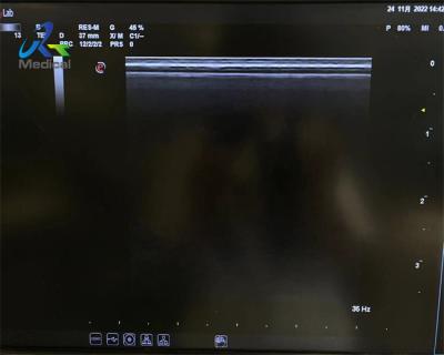 China Biosound Biosound SL1543 Linear Array Ultrasound Probe Repair Replace Lens And Crystal for sale