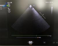 China GE S8-3 Ultrasound Probe Transducer Maintenance Image With Error for sale