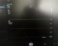 China GE S8-3 Ultrasound Probe Transducer Maintenance Image With Error for sale