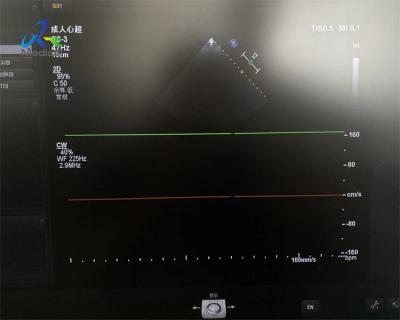 China GE S8-3 Ultrasound Probe Transducer Maintenance Image With Error for sale