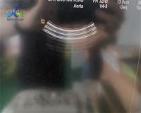 China Samsung V4-8 Ultrasound Transducer Probe Replace Crystal And Repair 4D for sale