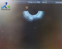 China GE RIC5-9-D Ultrasound Probe Repair 4D And Replace Dome In Operating Room for sale