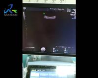 China GE Voluson E8 Ultrasound Machine Repair Abnormal Ultrasound Images Replace Rfm Board for sale