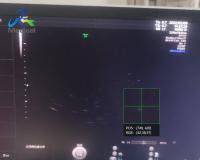 China GE Voluson E8 Ultrasound Machine Repair Abnormal Ultrasound Images Replace Rfm Board for sale