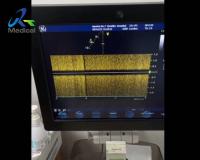 China GE Vivid S6 Ultrasound Machine Repair Interference In CW Mode Replace PIB Board for sale