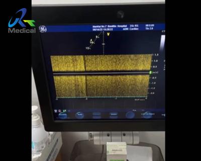 China GE Vivid S6 Ultrasound Machine Repair Interference In CW Mode Replace PIB Board for sale